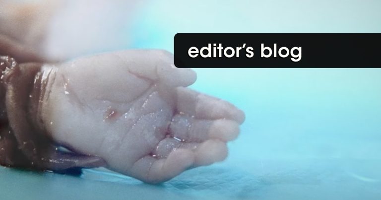 Pictures of Aborted Babies Are Necessary to Change Hearts - Celebrate ...